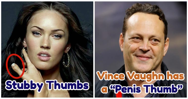 9 Weird Physical Flaws From Favorite Celebrities