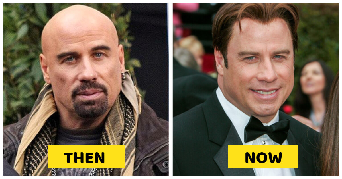 15 Celebrities With Extraordinary Transformations That Never Failed To ...